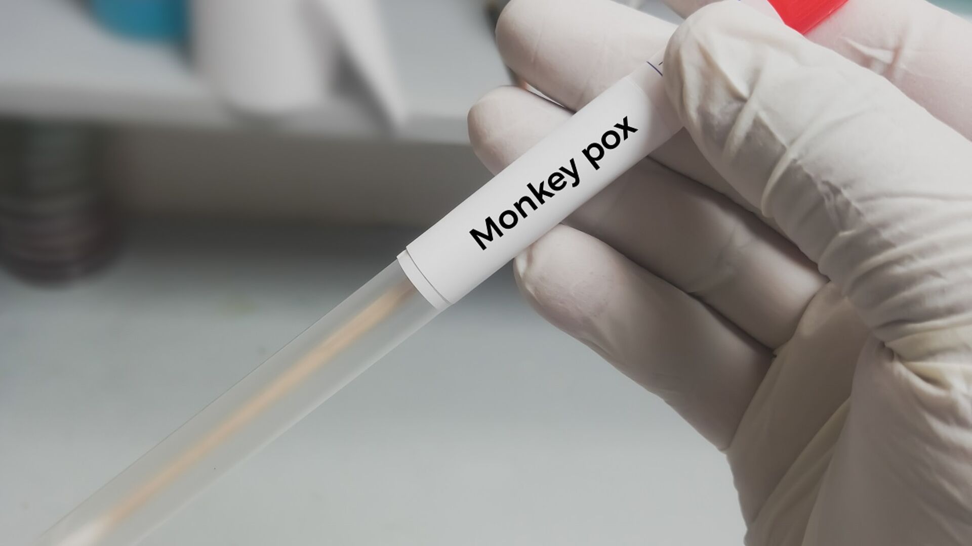 1100 ofiar mpox. Epidemia może "wymknąć się spod kontroli" - Zdrowie ...