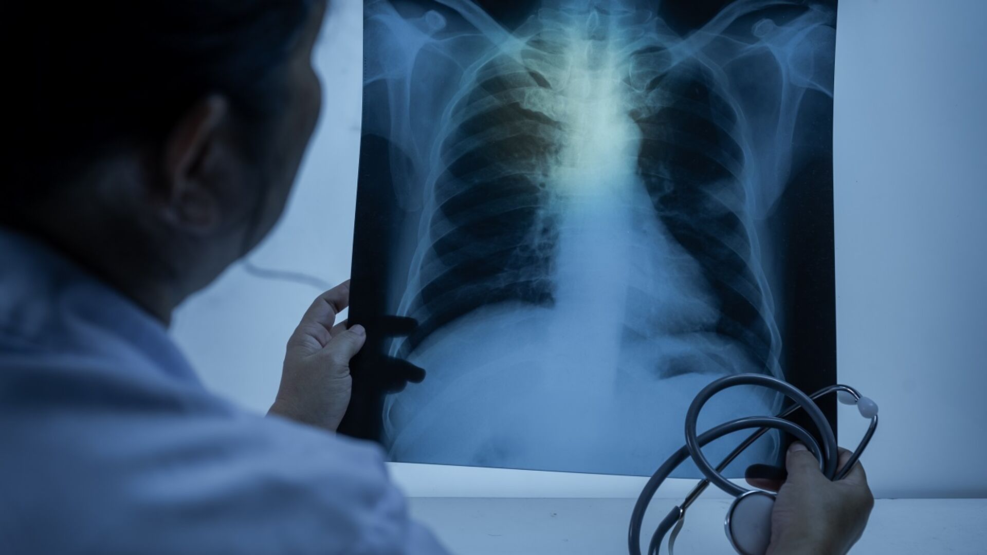 Ten symptom może wskazywać na raka płuc. Wiele osób nie ma o nim ...